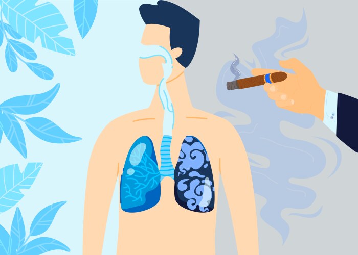 Lung Damage Vector Images (over 900)