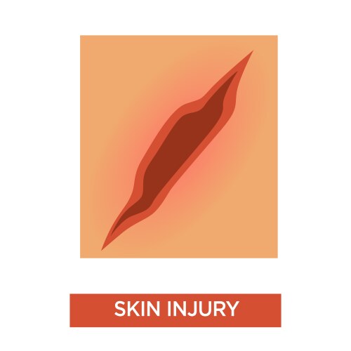 Skin cut wound with surgical stitches red mark Vector Image