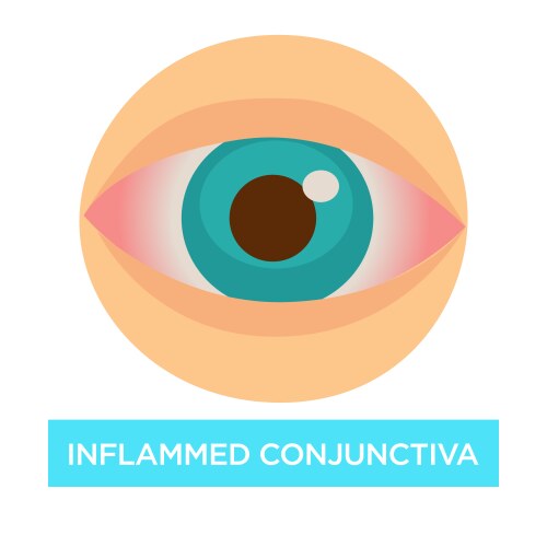 Conjunctiva Vector Images (over 190)