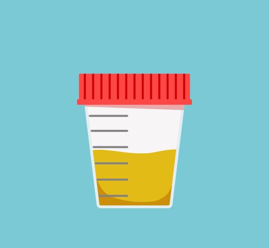 Urine Sample Vector Images (over 840)