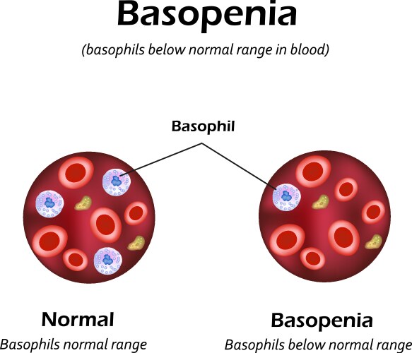 Monocytes below the normal range in blood Vector Image