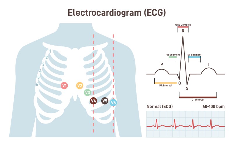 Ecg Vector Images (over 17,000)