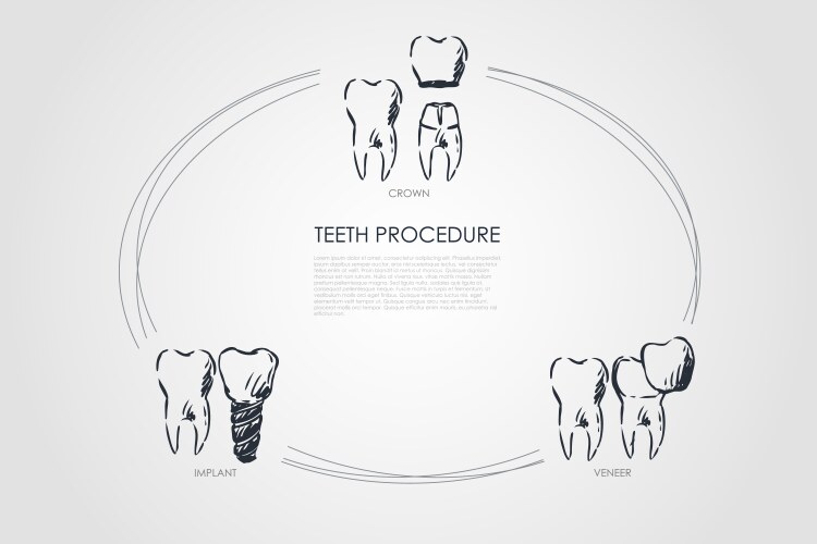 Crown Teeth Vector Images (over 4,500)