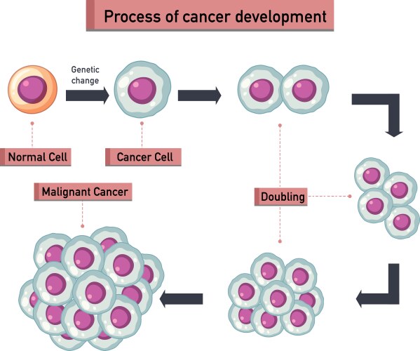 Cancer development process infographic Royalty Free Vector