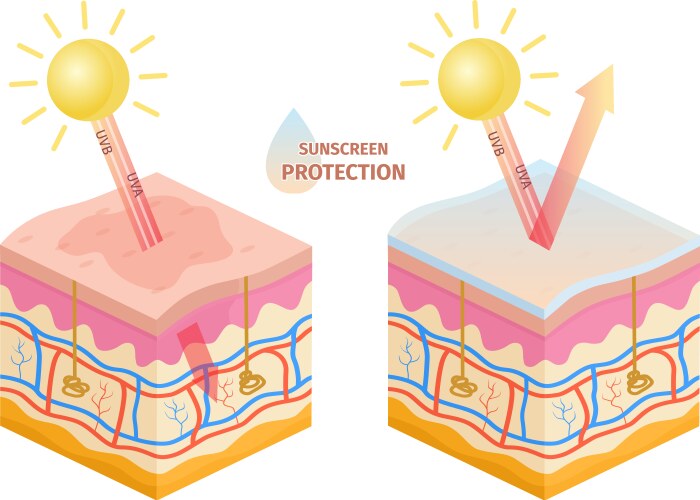 Burn Skin Vector Images (over 3,900)