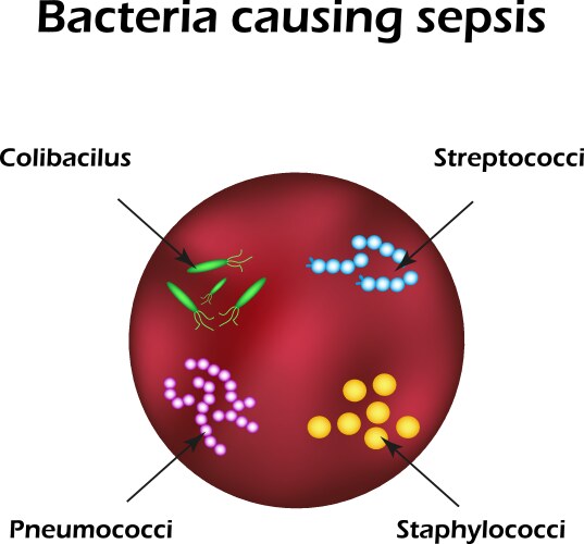 Sepsis blood poisoning e coli streptococci Vector Image