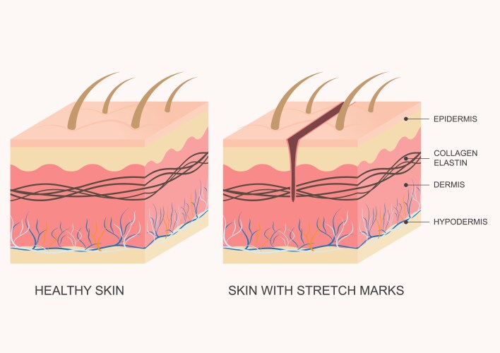 Scar Skin Vector Images (over 2,200)