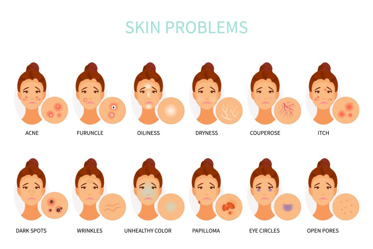 Skin Problems Oily Vector Images (over 390)