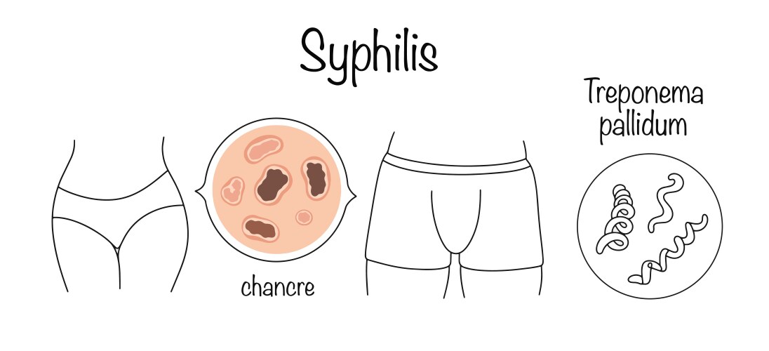 Syphilis Vector Images (over 430)