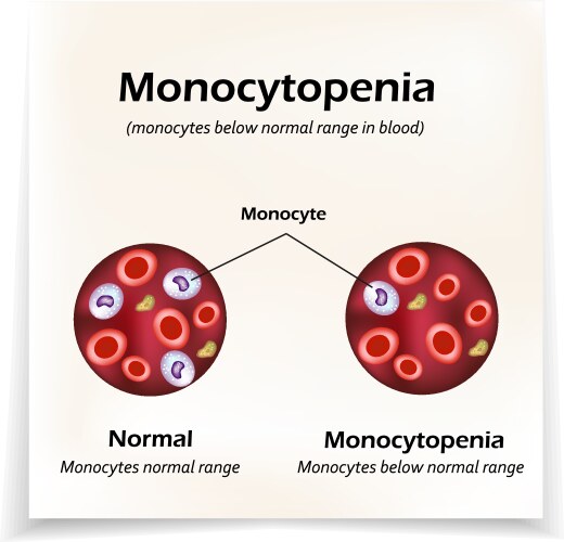 Monocytes below the normal range in blood Vector Image