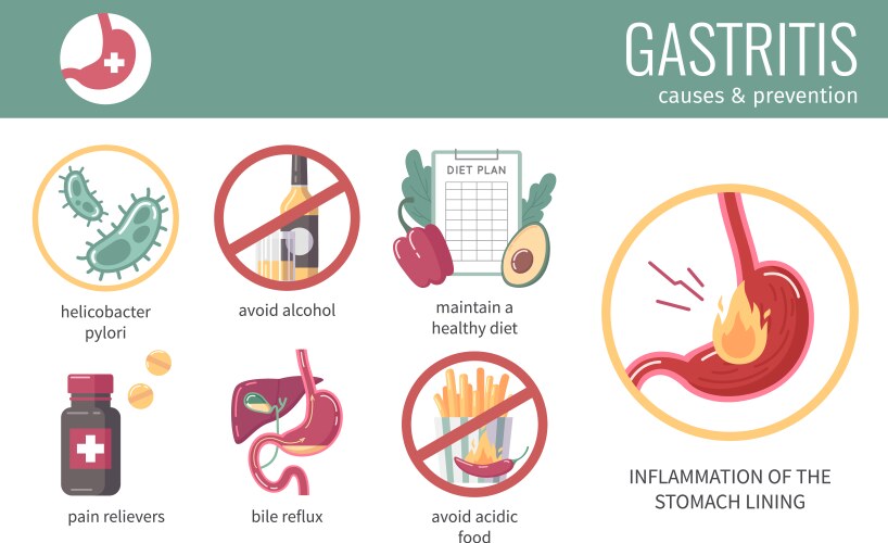 Gerd flat infographics Royalty Free Vector Image