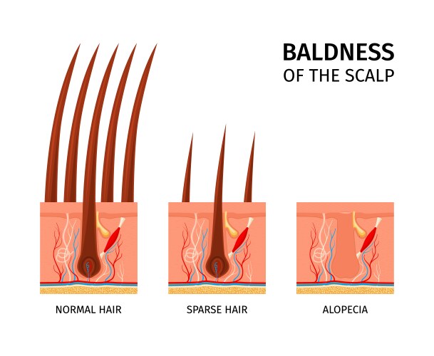 Scalp care icon Royalty Free Vector Image - VectorStock