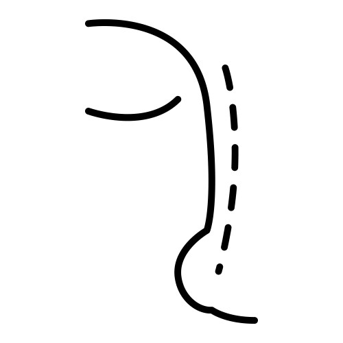 Nose Job Vector Images (over 520)