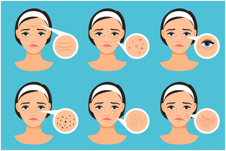 Female head with skin problems solution Royalty Free Vector
