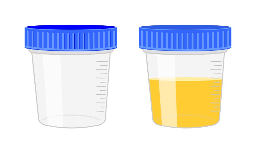 Urine Cup Vector Images (over 140)