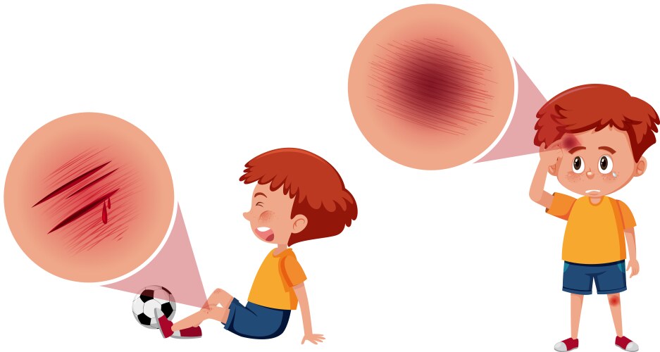 Wound Open Blood Vector Images (90)