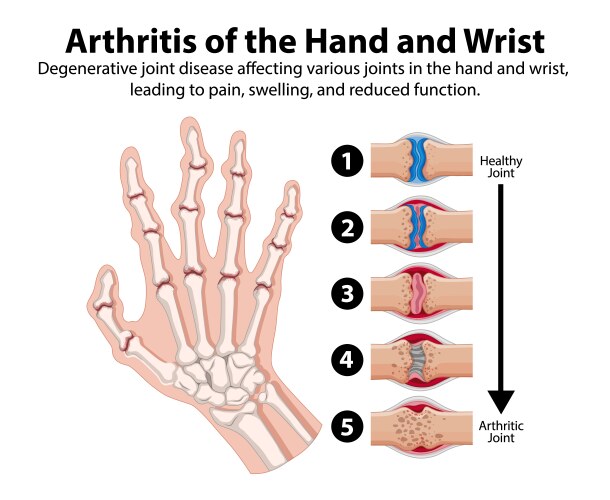 Joint Vector Images (over 50,000)