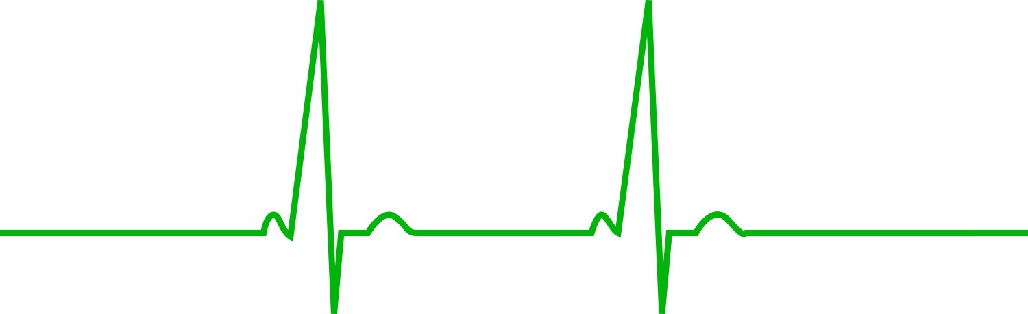 Heart beat line cardiogram pulse Royalty Free Vector Image
