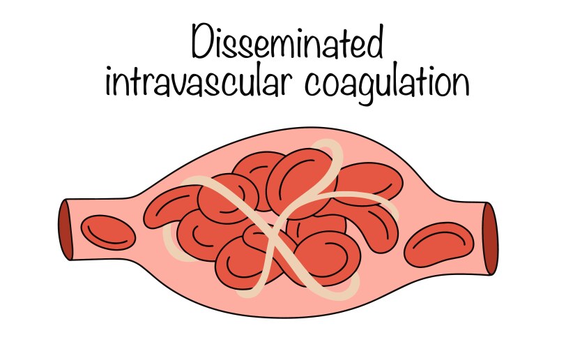Coagulation Vector Images (over 1,200)