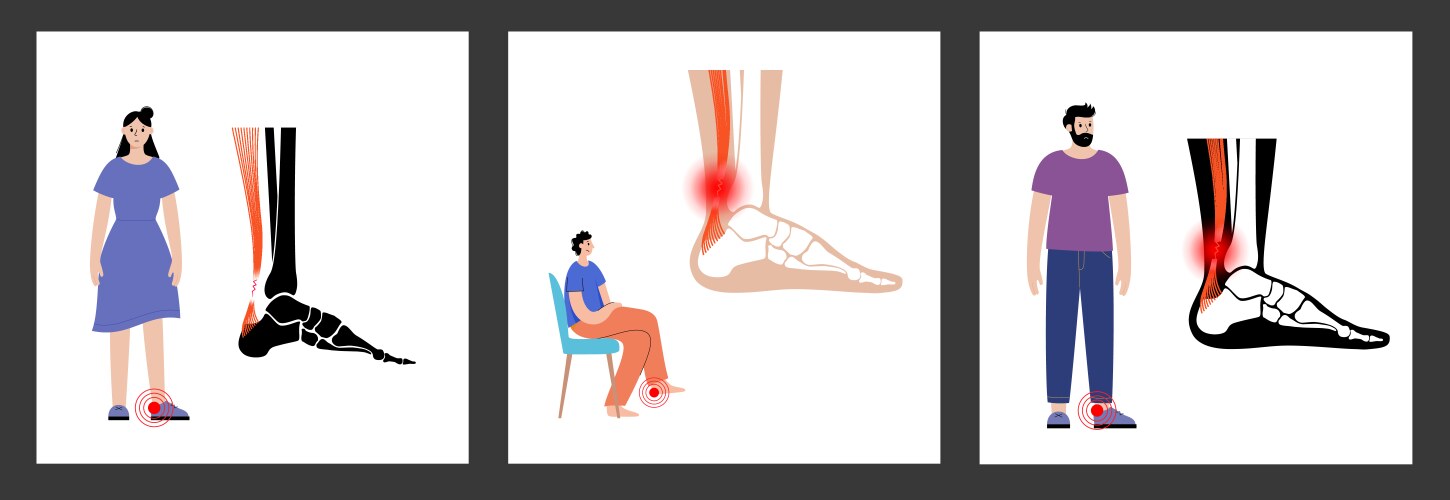 Medical infographic achilles tendon Royalty Free Vector