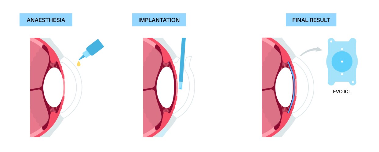 Evo icl poster Royalty Free Vector Image - VectorStock