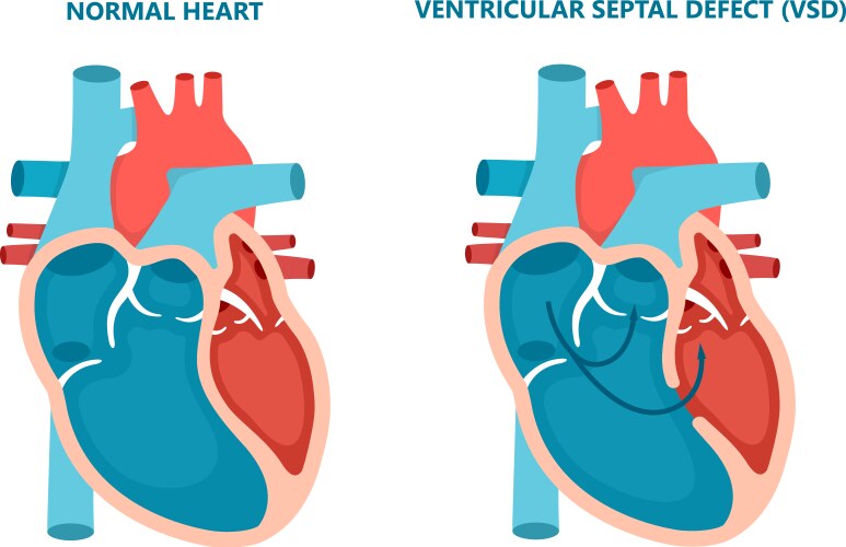 Human heart anatomically correct Royalty Free Vector Image