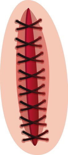 Incision suture icon cartoon style Royalty Free Vector Image