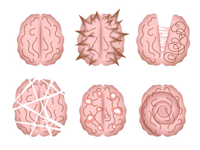 Disorder Vector Images (over 58,000)