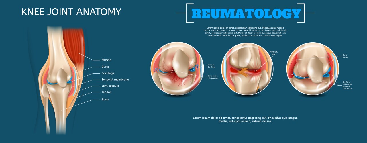 Human knee joint anatomy realistic scheme Vector Image