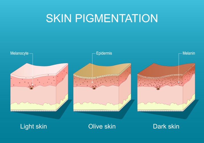 Skin Disorder Vector Images (over 1,300)