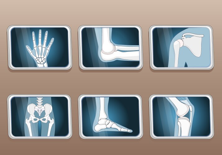Types of joints Royalty Free Vector Image - VectorStock