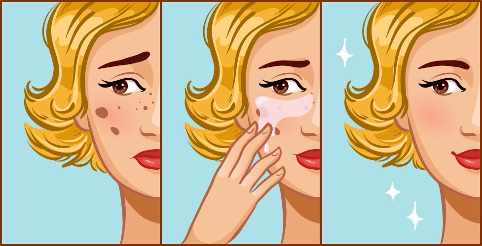 Pigmentation Face Vector Images (over 1,000)