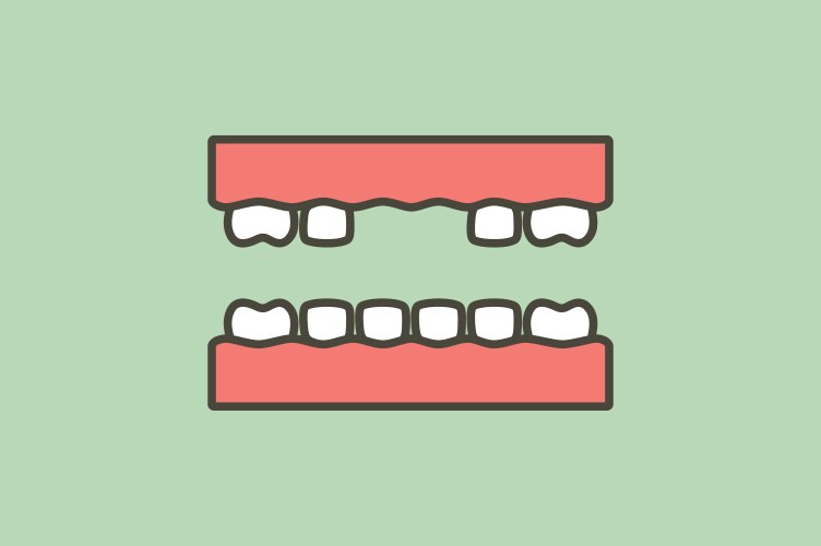 Lose Teeth Vector Images (89)