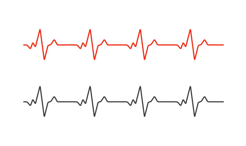 Electrocardiogram Vector Images (over 16,000)