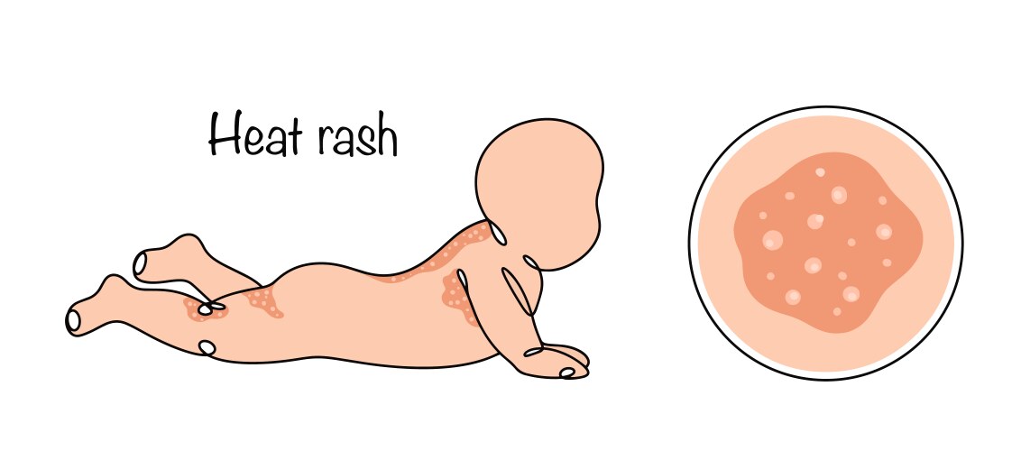 Heat Vector Images (over 370,000)