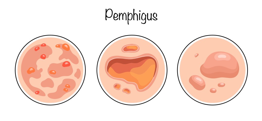 Skin Lesions Vector Images (over 400)