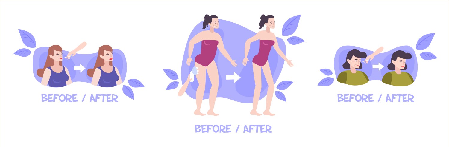 Before Vector Images (over 13,000)