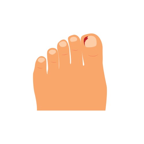 Cartoon Foot Vector Images (over 38,000)