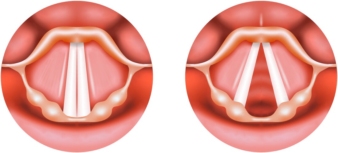 Vocal Vector Images (over 22,000)