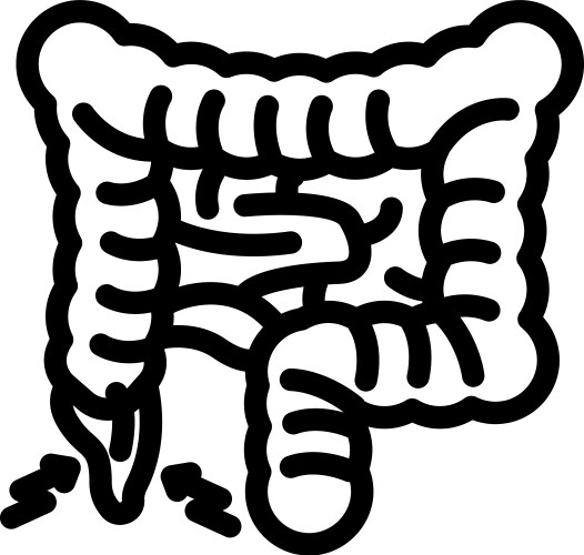 Appendectomy Vector Images (40)