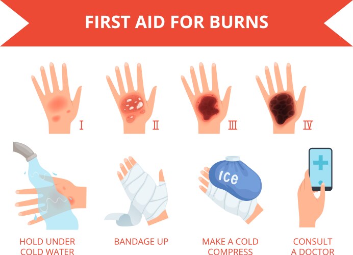 Burns degree first aid for burn wound fire Vector Image