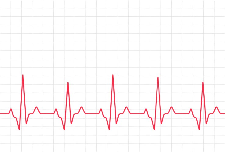 Ecg Vector Images (over 16,000)