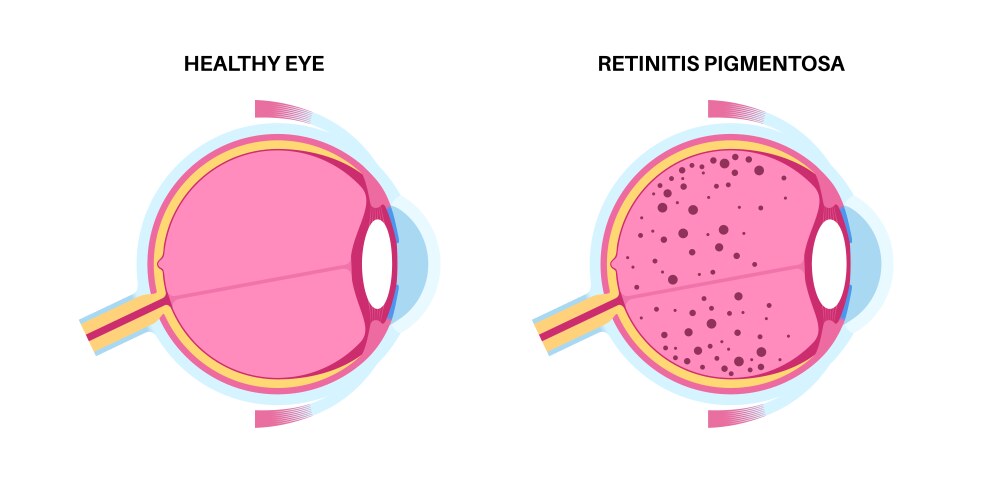 Retinal Vector Images within Science (over 110)