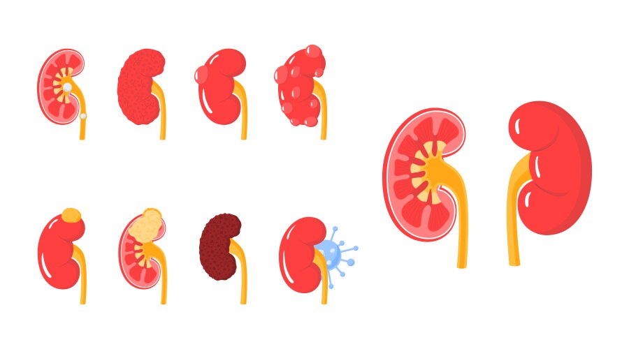 Nephrology Vector Images (over 1,100)