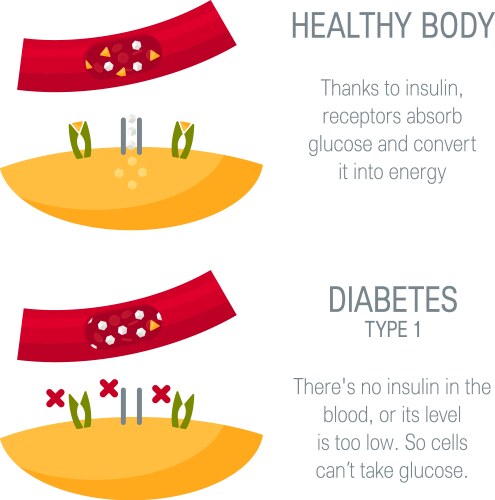 Diabetes concept in flat style icon Royalty Free Vector