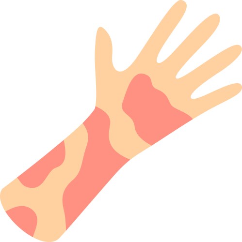 Red Rash Vector Images (over 2,800)