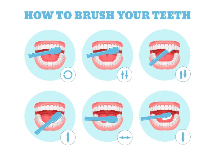 Toothbrushing Steps - Oral Hygiene Guide – Royalty-Free Vector ...