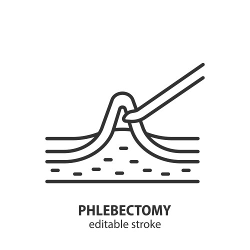 Phlebitis Vector Images (over 190)