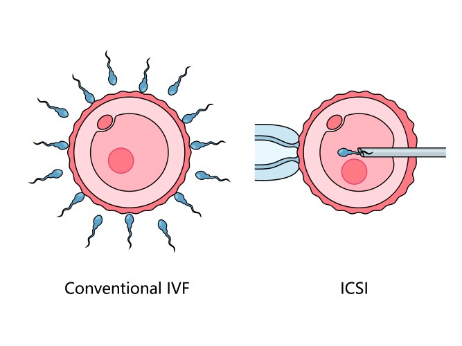 Icsi Vector Images (86)