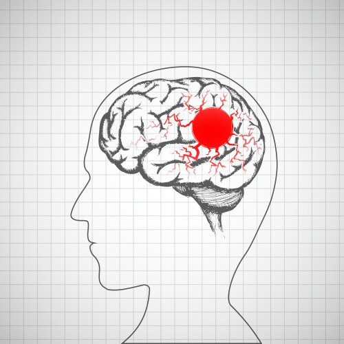 Sick Brain Vector Images (over 6,000)